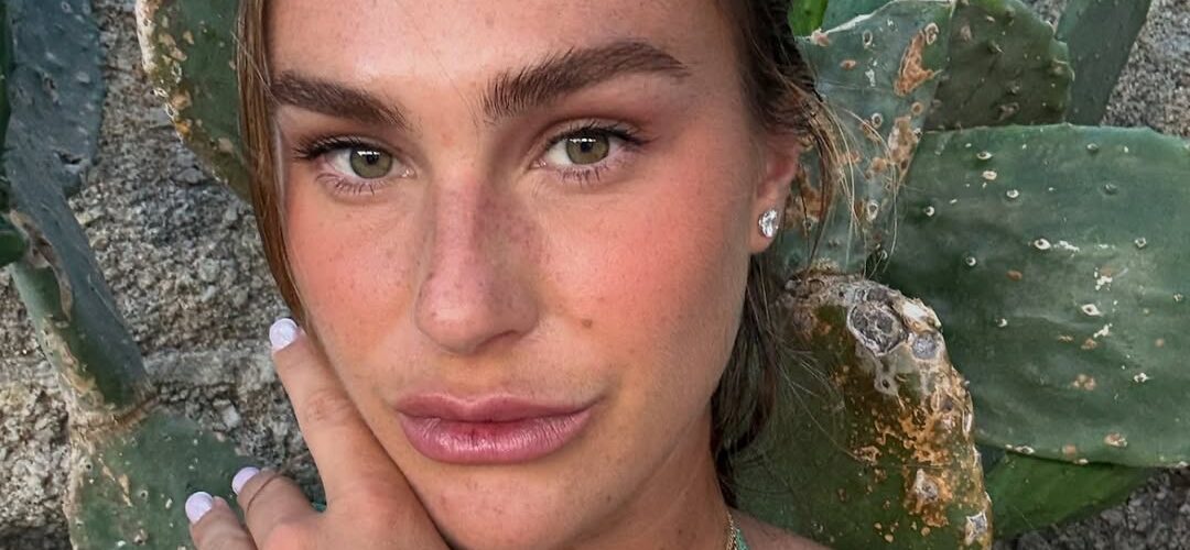 Aryna Sabalenka Poses Topless, But Fans Focus On Her 'Frightening' Lips